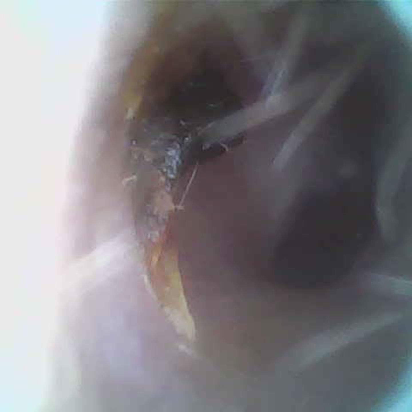 Ear, Nose & Throat Smart Wi-Fi Otoscope With HD Camera - MOBI USA