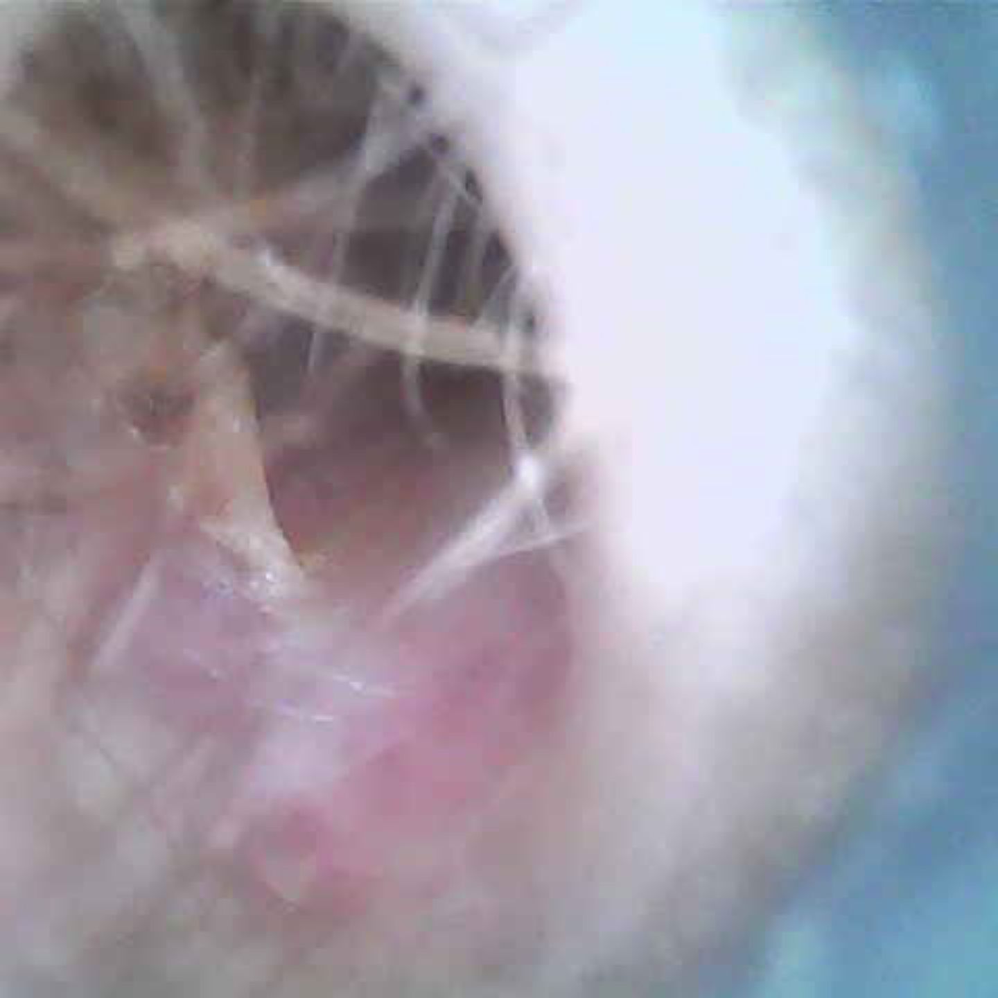 Ear, Nose & Throat Smart Wi-Fi Otoscope With HD Camera - MOBI USA