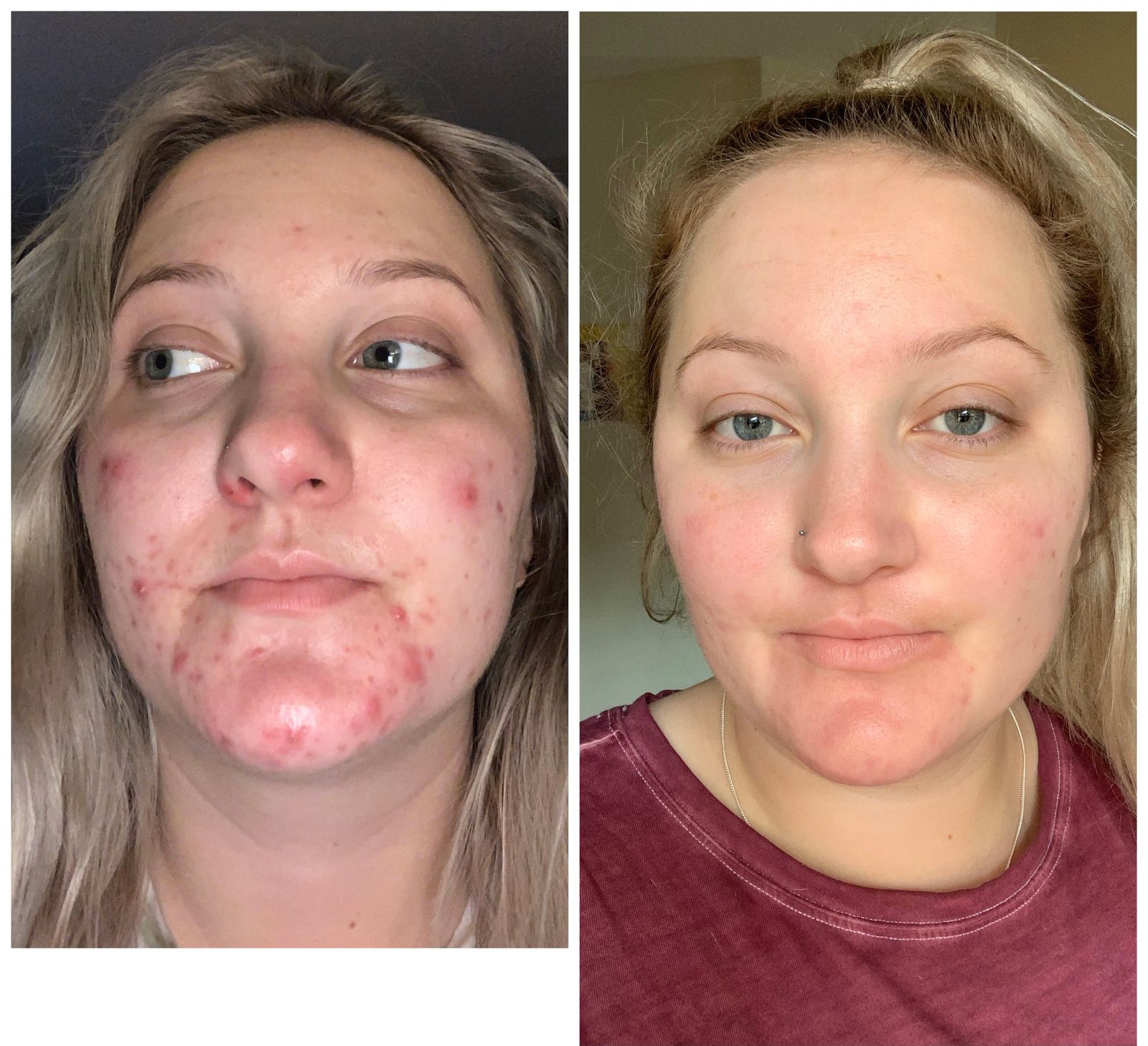 POREFAVOR Customer Reviews – PORE FAVOR USA