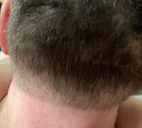 Neck Guide | Skull Shaver