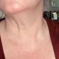 LED Neck and Dec Perfector | Chest Wrinkle Treatment | CurrentBody Skin