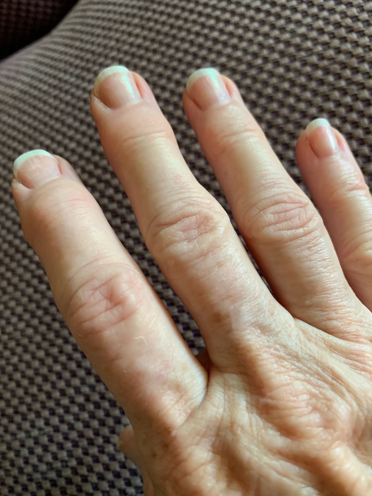 Spectrum 5 Collagen™ Type I, II, III, V, & X | Amy Myers MD