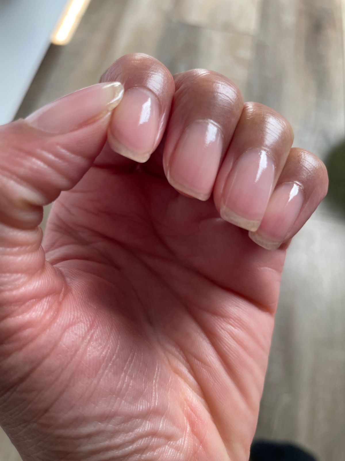 First Aid Kiss | Nail Strengthener - Stop Peeling, Cracking Weak Nails ...