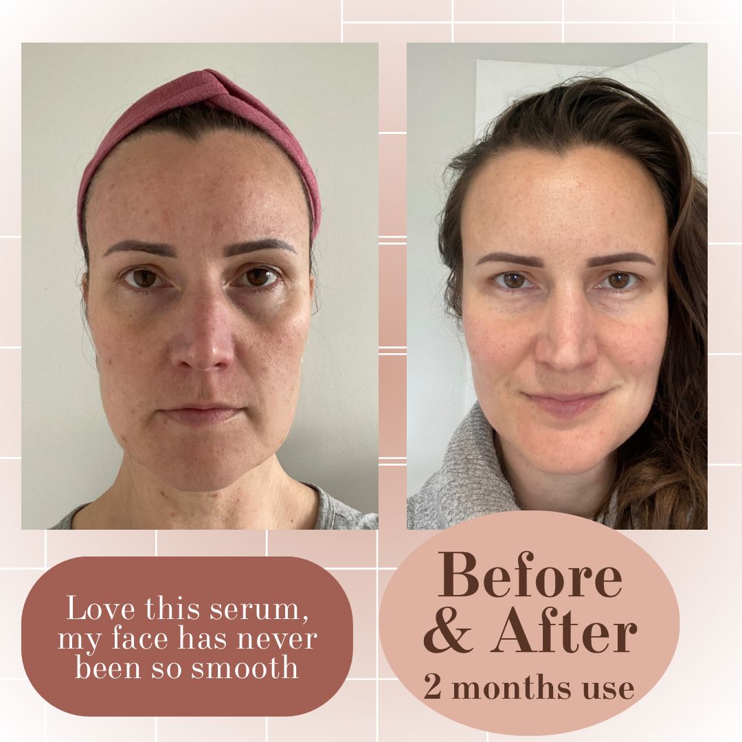 Perimenopausal Breakout Bundle – BOOST LAB