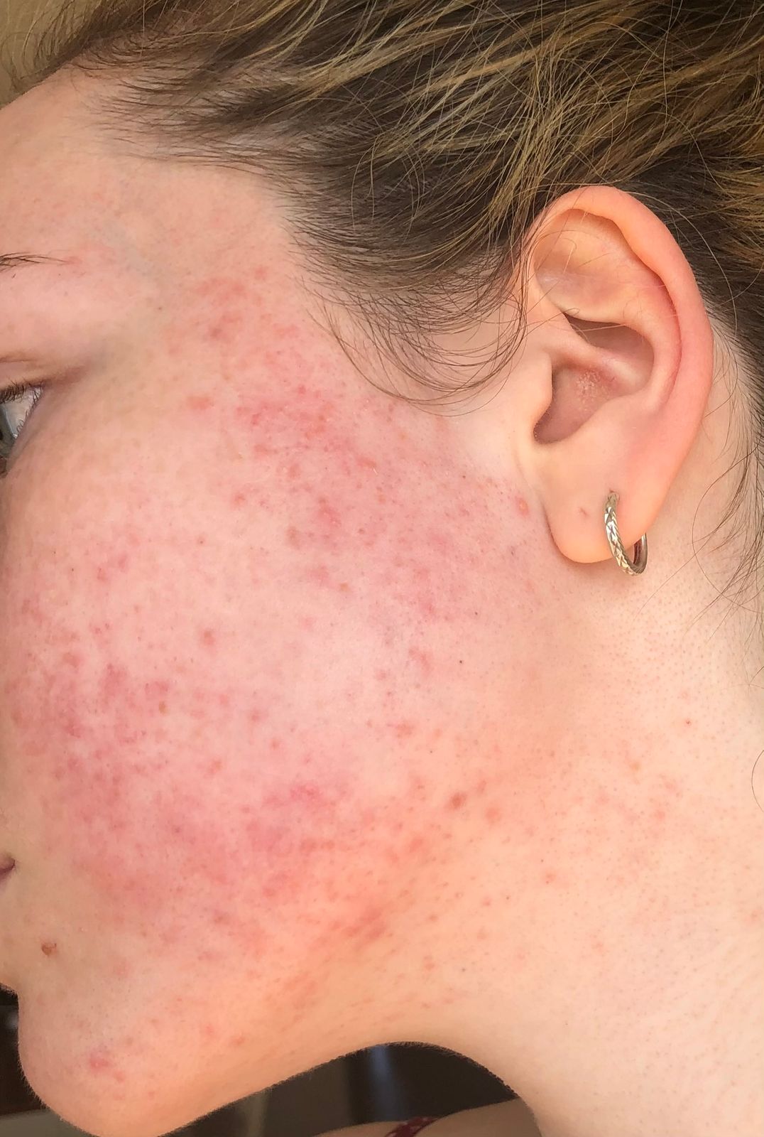 10% Mandelic Acid Treatment | The INKEY List