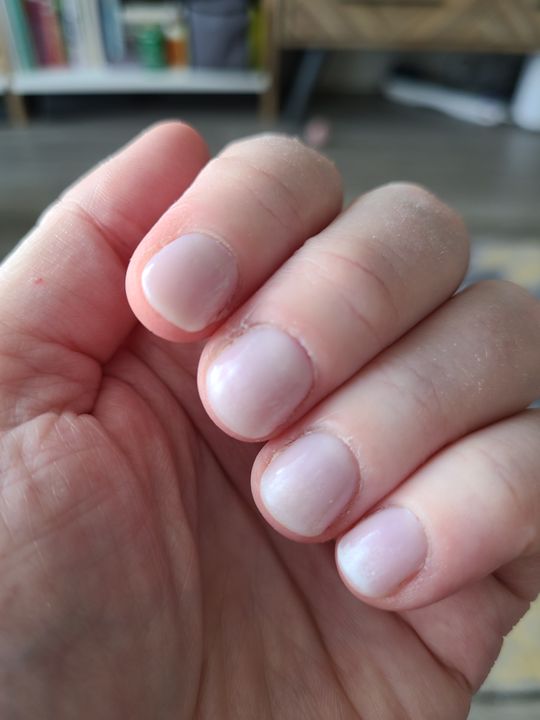 Illuminating Nail Concealer | Nail Care | LONDONTOWN