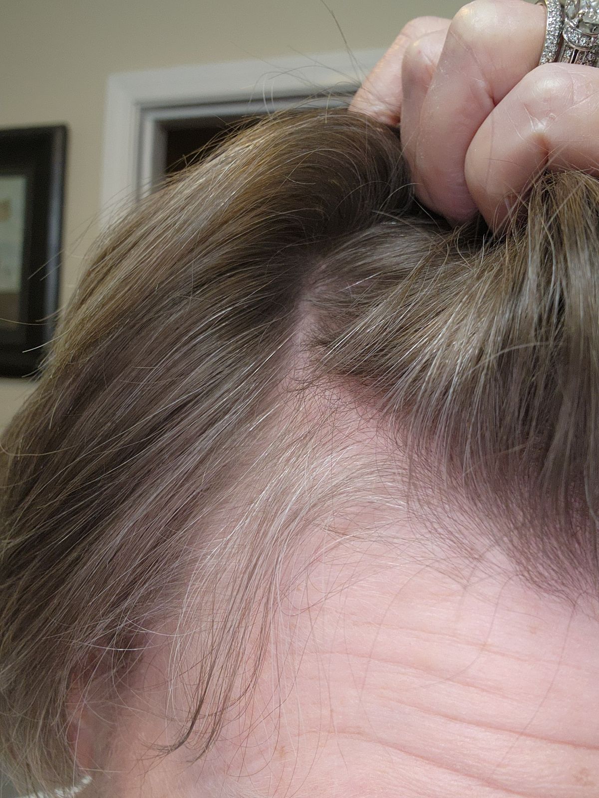 Collagen with Dermaval | 1st Phorm