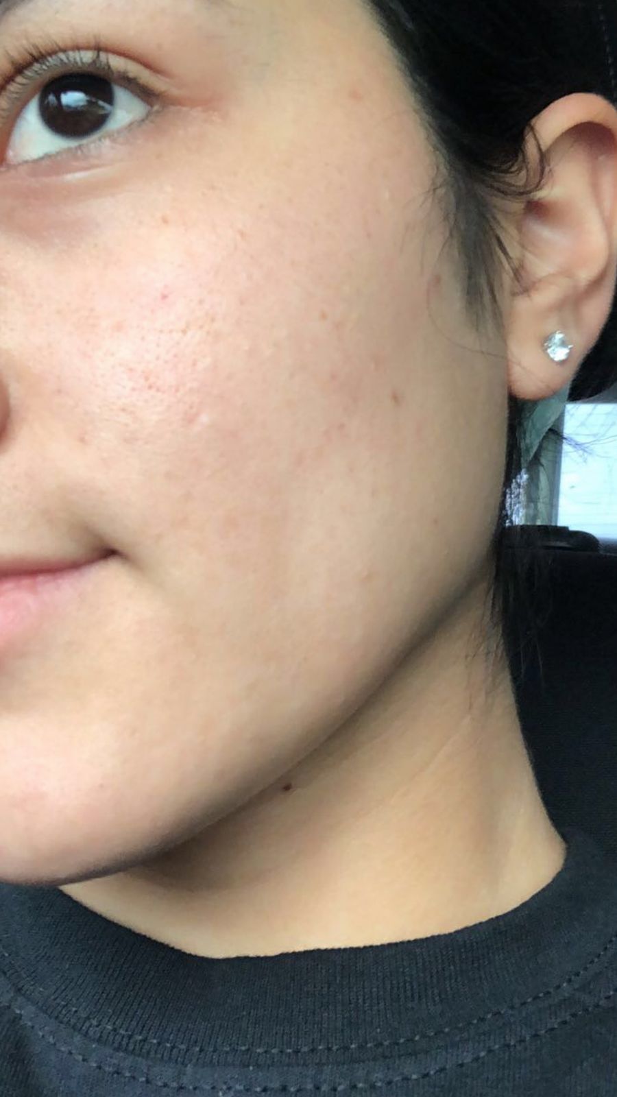 Collagen with Dermaval