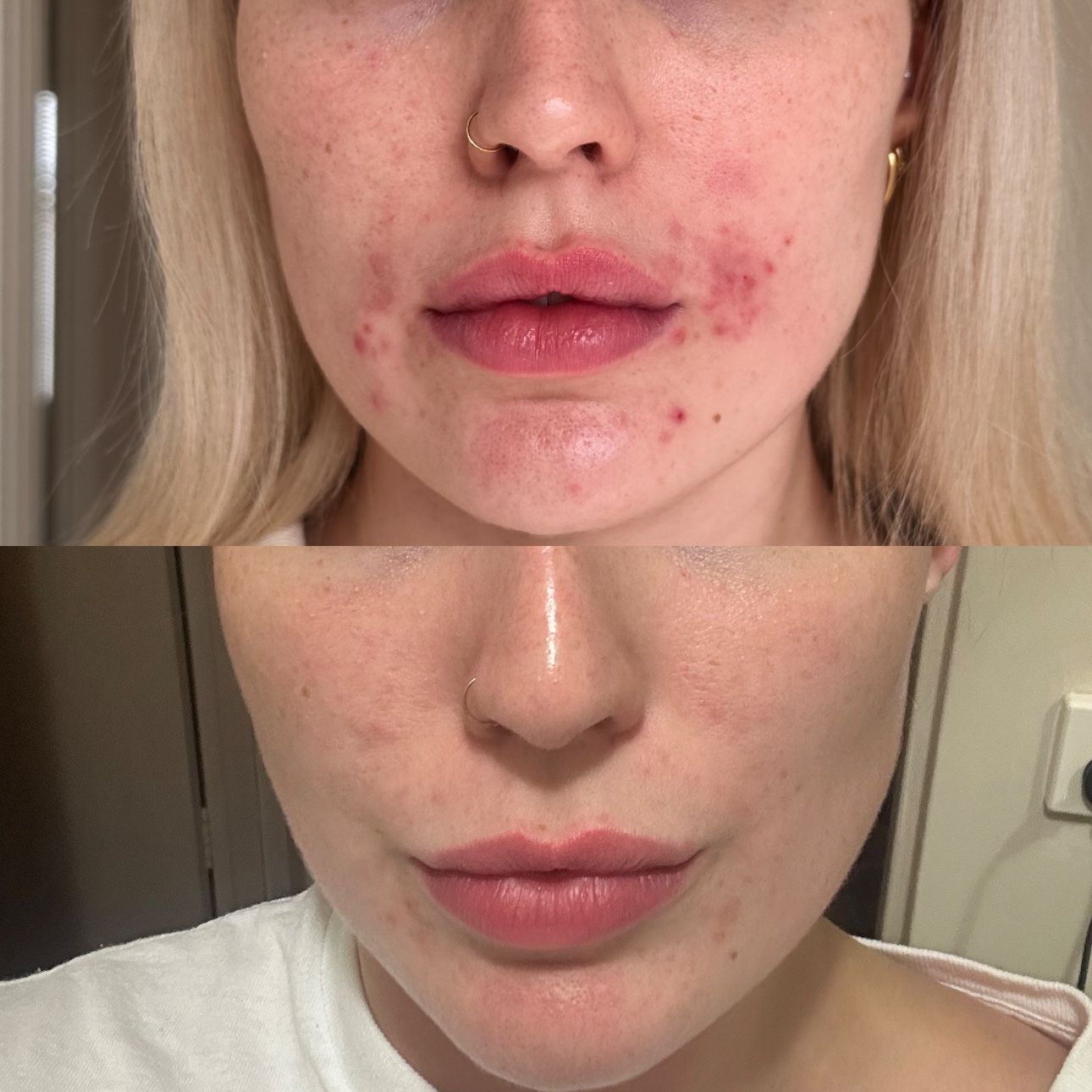 the ultimate starter pack – tbhskincare